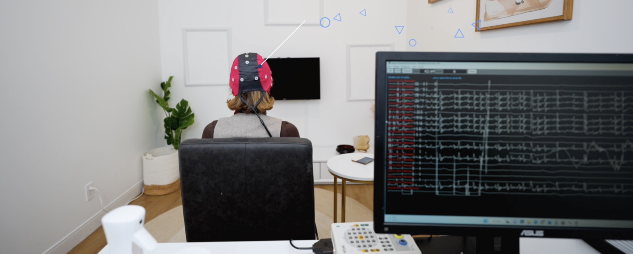 QEEG Brain Map - Elumind Centres